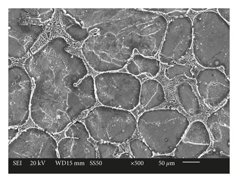 Solidification Structure Of The Sample Under The High Undercooling