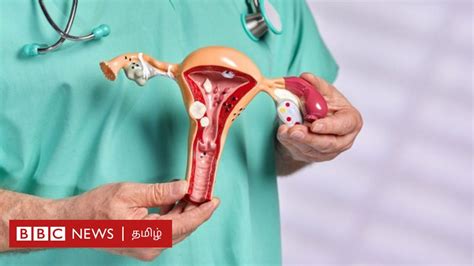 உடல்நலம் கர்ப்பப்பை இல்லாத பெண்கள் இந்த பிரச்னை குறித்து தெரியுமா Bbc News தமிழ்