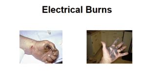Electrical Hazards Awareness For Workers And Home Technicians