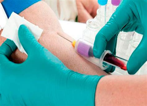 Pruebas De Laboratorio Clínico Orl Group Ecuador