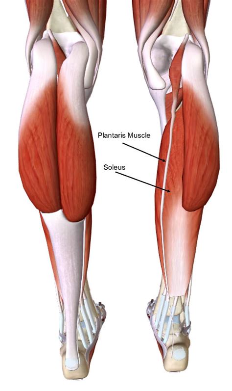 Plantaris Muscle Rupture