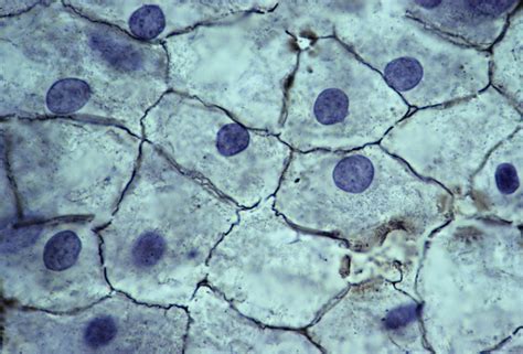 What Are Mesothelial Cells Function And Structure