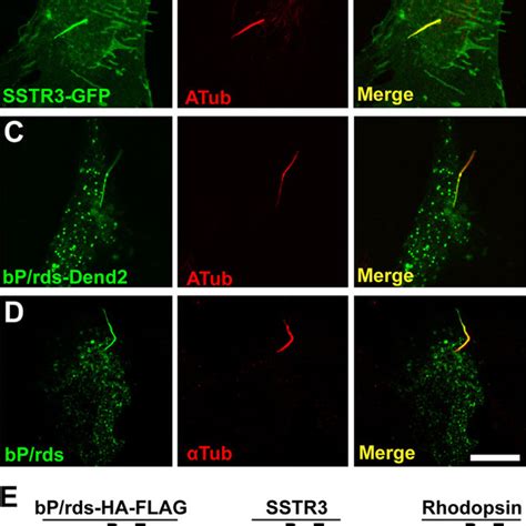 Cilia Targeting Of Prds In Cilia Is Dependent On Copii But Not On The