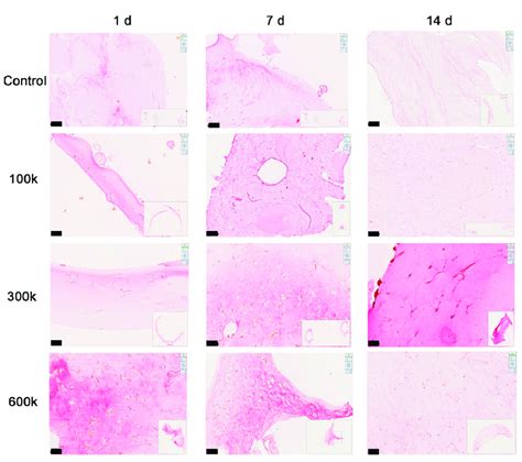Influence On Collagen Organization Of The Vnf Of Hpmec Seeded In Lv Ecm