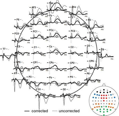 Hep Morphology Grand Average Waveforms Across The Scalp Time Locked To Download Scientific