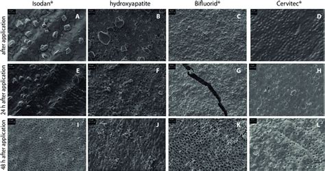 Surface Morphology Of Dentin Specimens After Treatment With Commercial Download Scientific