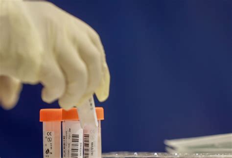 БНХАУ д өнгөрсөн долоо хоногт 648 хүн КОВИД 19 өвчнөөр нас баржээ