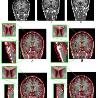 One Volunteer Was Scanned For Testing Purposes At Different Positions Download Scientific