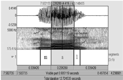 Spectrogram Showing Measurement Of Formants And Duration Download