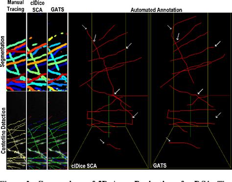 Improved Topological Preservation In 3d Axon Segmentation And