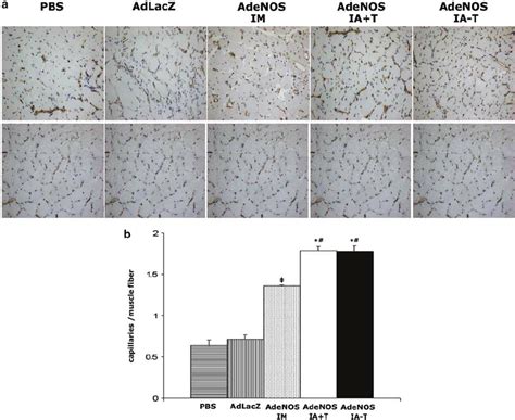 Adenos Delivery Increased Gastrocnemius Capillary Density A Cd31