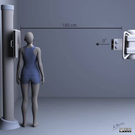 Image Radiopaedia Org