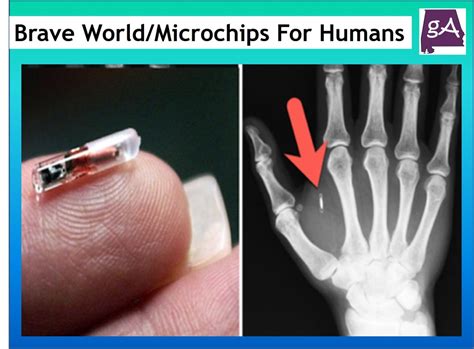 The Brave New World Of Microchips For Humans