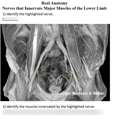 Lumbar Plexus Exercise 28 Meninges Spinal Cord And Spinal Nerves 1 2 Diagram Quizlet