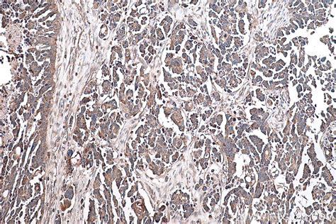 Ihceasy Gstcd Ready To Use Ihc Kit Khc0787 Proteintech 武汉三鹰生物技术有限公司