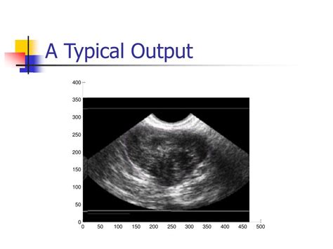 Ppt Segmentation Using Active Contour Model And Tomlab Powerpoint