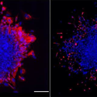 Extended Human Blastocyst Culture Human Embryos Grown In Extended Embryo Download Scientific
