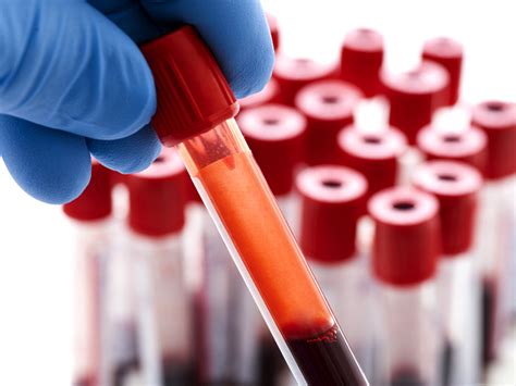 How Often Should I Have My Cholesterol Checked Silversneakers