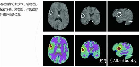 Openmmlab打卡笔记（6） 语义分割算法基础 知乎