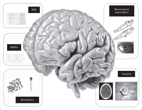 Prognostication After Cardiac Arrest Current Opinion In Critical Care