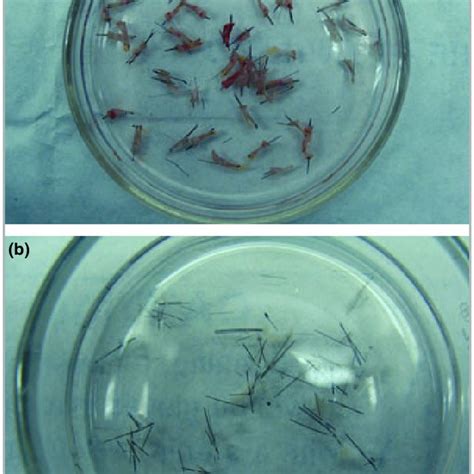 Pdf Noncultured Extracted Hair Follicle Outer Root Sheath Cell
