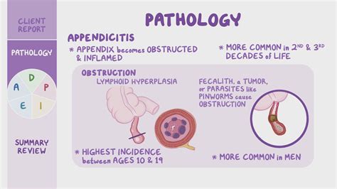 Is Appendicitis Hereditary