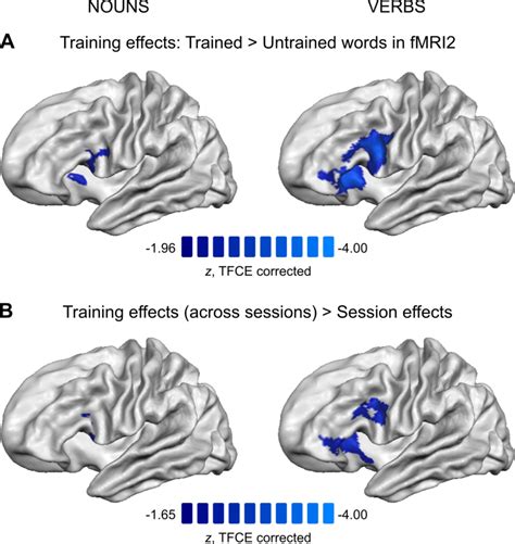 Training Effects Revealed By The Univariate Rfx Glm Analysis N 20 Download Scientific