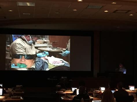 Dr John Kois Provides Commentary On A Procedure Performed By Dr John Kois Center Llc