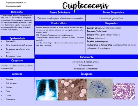 Tratamiento De Criptococosis Y Diagnóstico Pdf Enfermedades