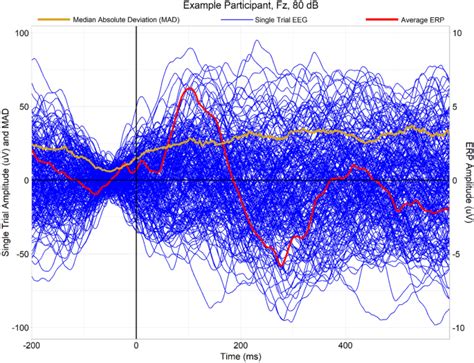 自闭症和神经典型儿童听觉反应中的“神经噪声” Journal Of Autism And Developmental Disorders X Mol
