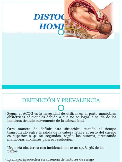 Manejo De La Distocia De Hombros Pdf Parto Hombro