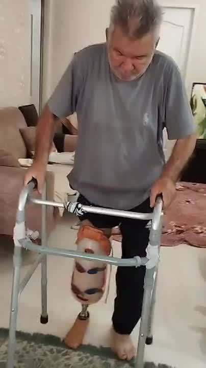 Mahmoud Mousavi On Linkedin Two Weeks After His Amputation I Told Him