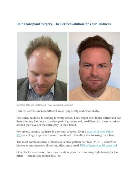 Ppt Hair Transplant Surgery The Perfect Solution For Your Baldness