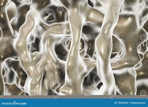 Normal Bone Structure Density And With Osteoporosis Royalty Free Stock