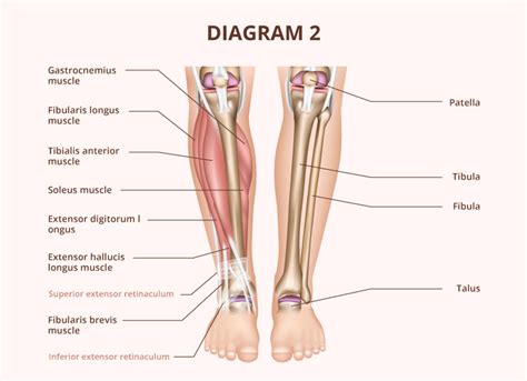 Shin Splints Psoriatic Arthritis At Marsha Shain Blog