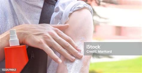 여름날 자외선으로부터 피부를 보호하기 위해 플라스틱 용기에서 선크림을 바르는 백인 남성의 손 햇볕 차단 로션에 대한 스톡 사진 및 기타 이미지 Istock
