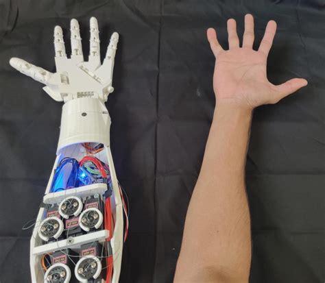 Arduino On Linkedin Designing A 3d Printed Emg Bionic Hand As A Low