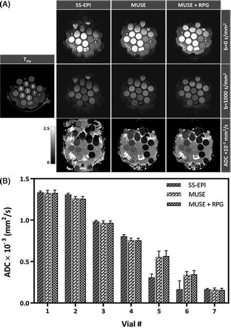 diffusion weighted echo planar imaging using multiplexed sensitivity encoding and reverse