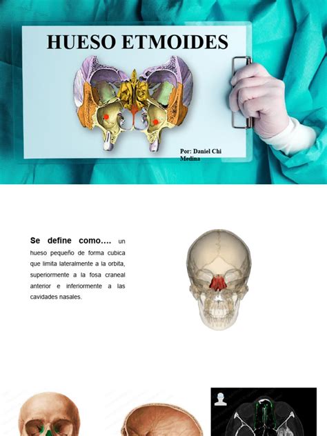 Hueso Etmoides Pdf