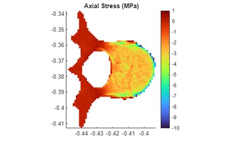 Medical Image Based Finite Element Analysis Of Spine Matlab And Simulink