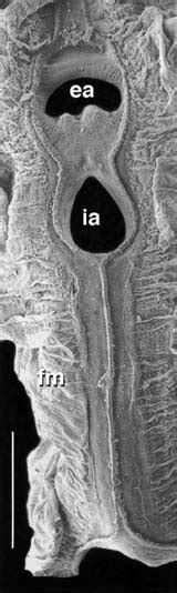 Posterior Apertures Showing Extensive Mantle Fusion Involving Inner Download Scientific
