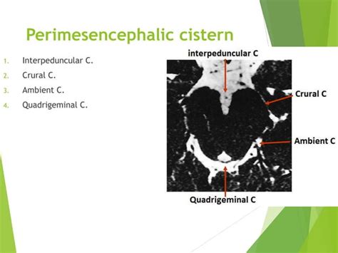 Basal Cisterns Final Ppt