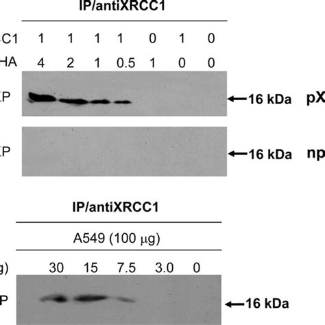 Simultaneous Monitoring Of Kinase And Phosphatase Activities Of Pnkp Download Scientific