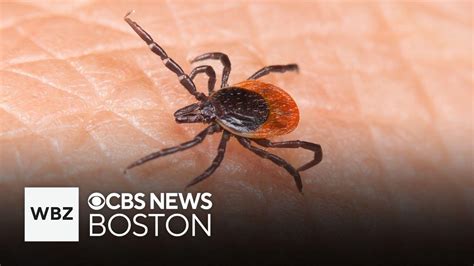 Its Been A Bad Summer For Tick Bites In The Northeast Heres Why And