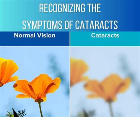 Recognizing The Symptoms Of Cataracts Cumberland Eye Care