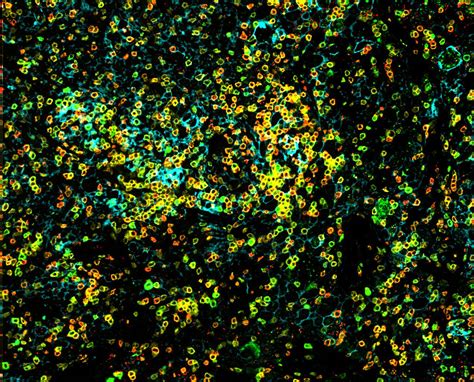 Drug Inducible Gene Therapy Yields Encouraging Preliminary Results In