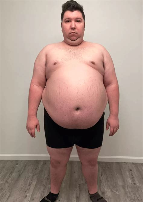 Nikocado Avocado Fans Spot ‘proof That Dramatic Weight Loss Is Real