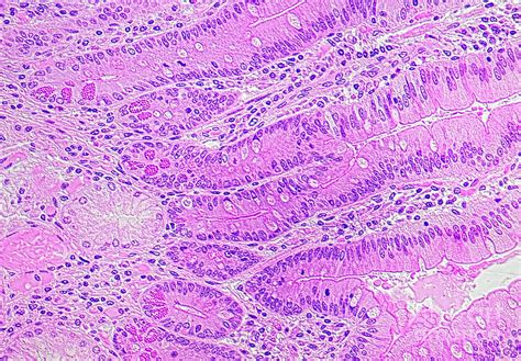 Duodenum Wall Ts For Paneth Cells Photograph By M I Walker Fine Art America