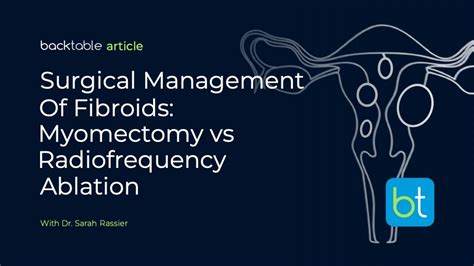 Surgical Management Of Fibroids Myomectomy Vs Radiofrequency Ablation