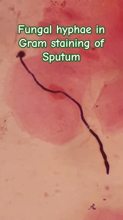 Fungal Hyphae In Gram Stain Of Sputum Science Mycology Shorts Youtube
